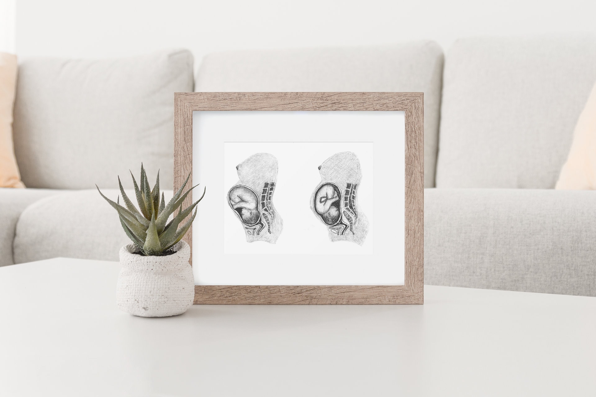 Posterior and Anterior Fetal Presentations: Birth/doula/midwife Art ...