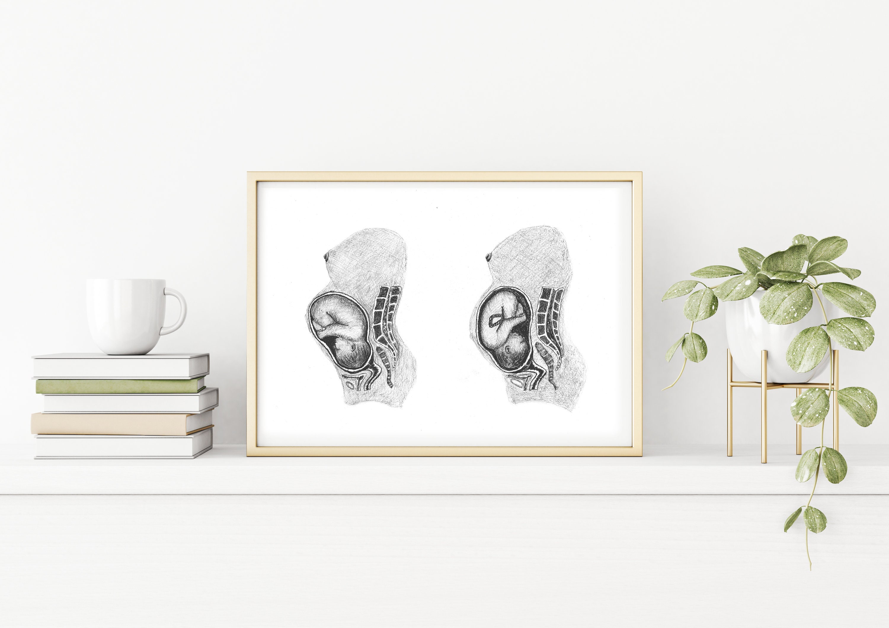 Posterior and Anterior Fetal Presentations: Birth/doula/midwife Art ...