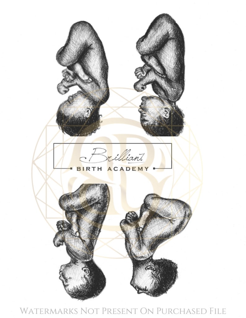 Fetal Positioning: Flexion - Etsy