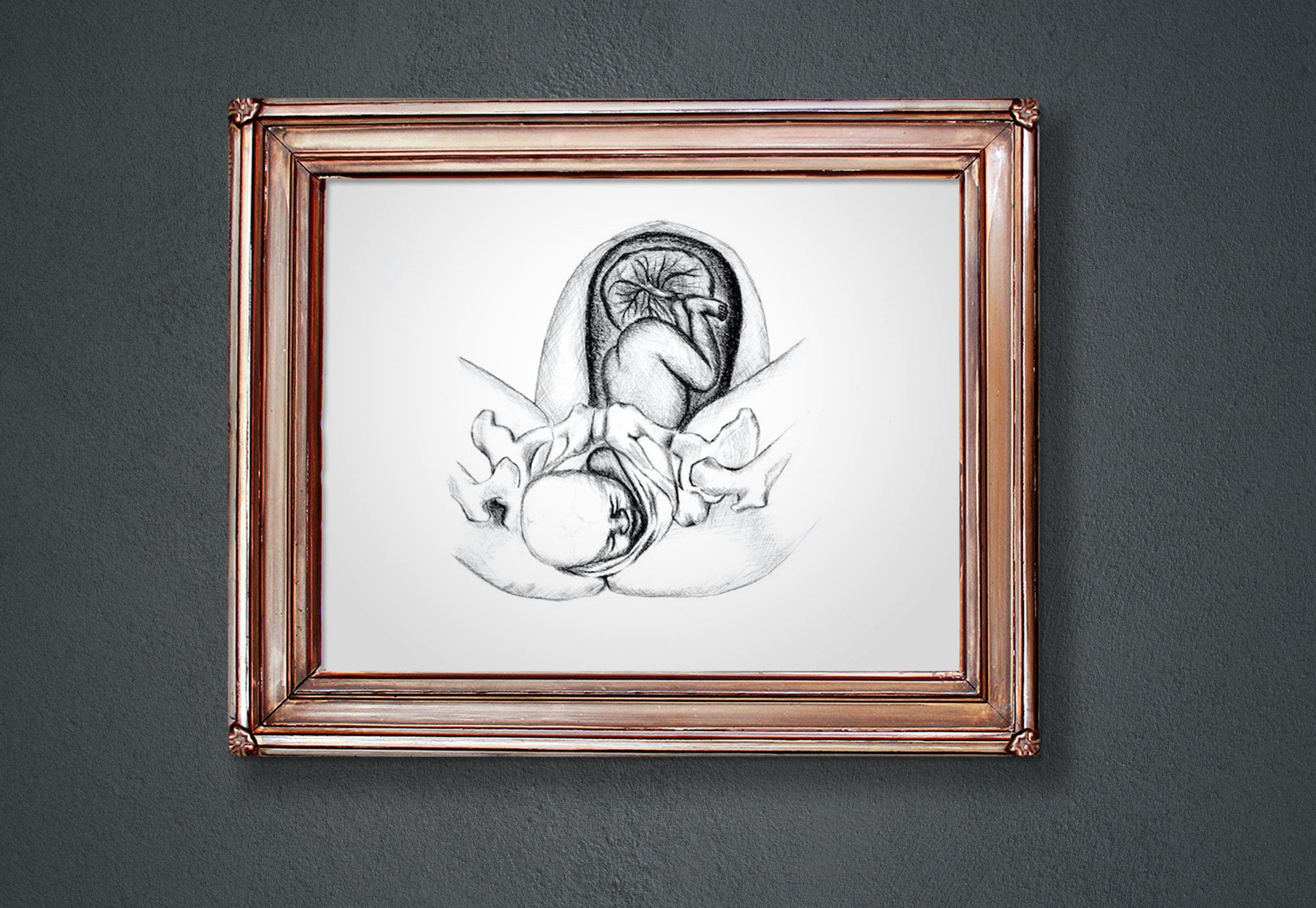 Cardinal Movements of Labor: Internal Rotation - Etsy