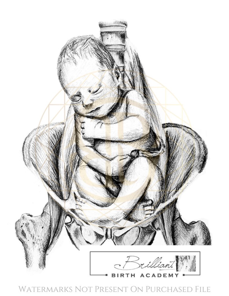 Breech Presentation: Birth/doula/midwife Art Printable - Etsy