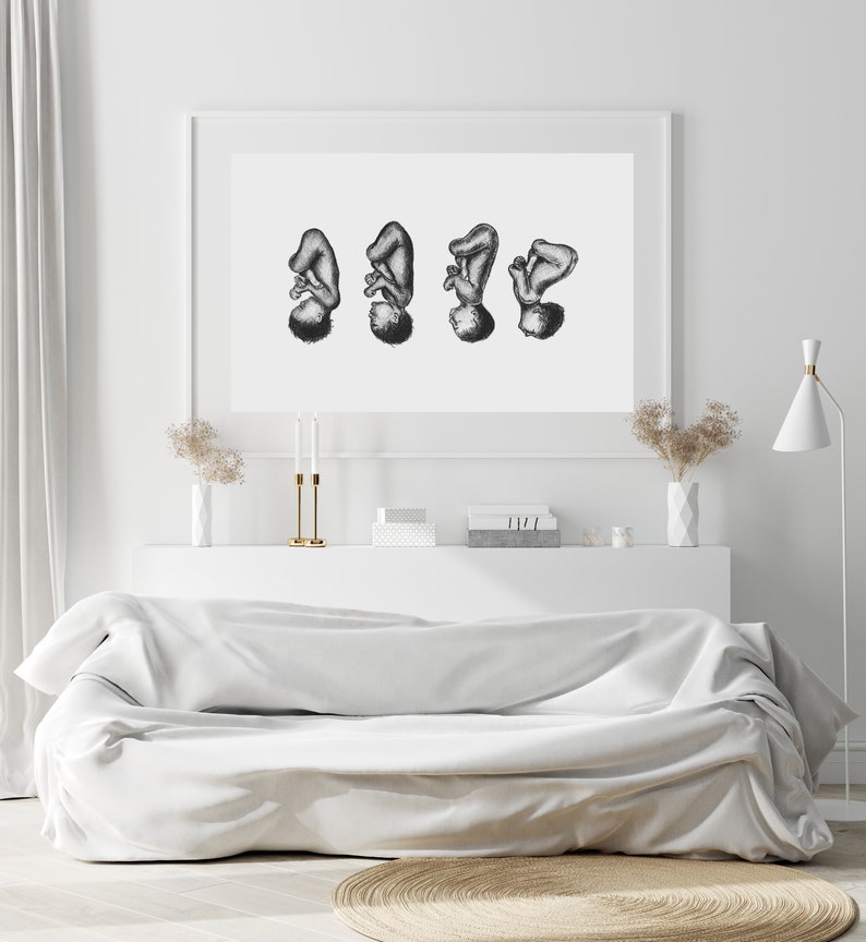 Fetal Positioning: Flexion - Etsy