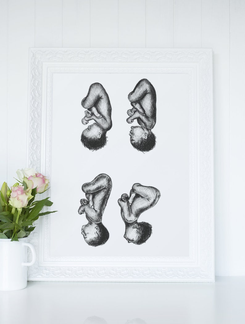 Fetal Positioning: Flexion - Etsy