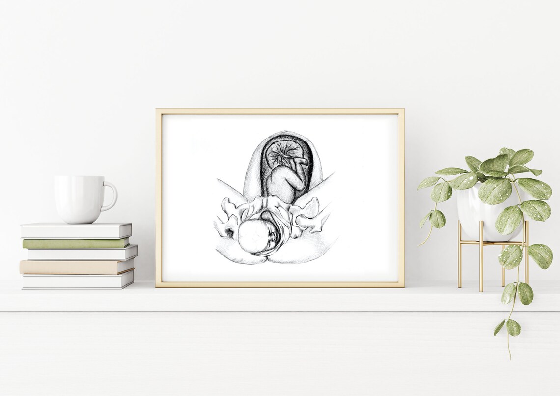 Cardinal Movements of Labor: Internal Rotation - Etsy