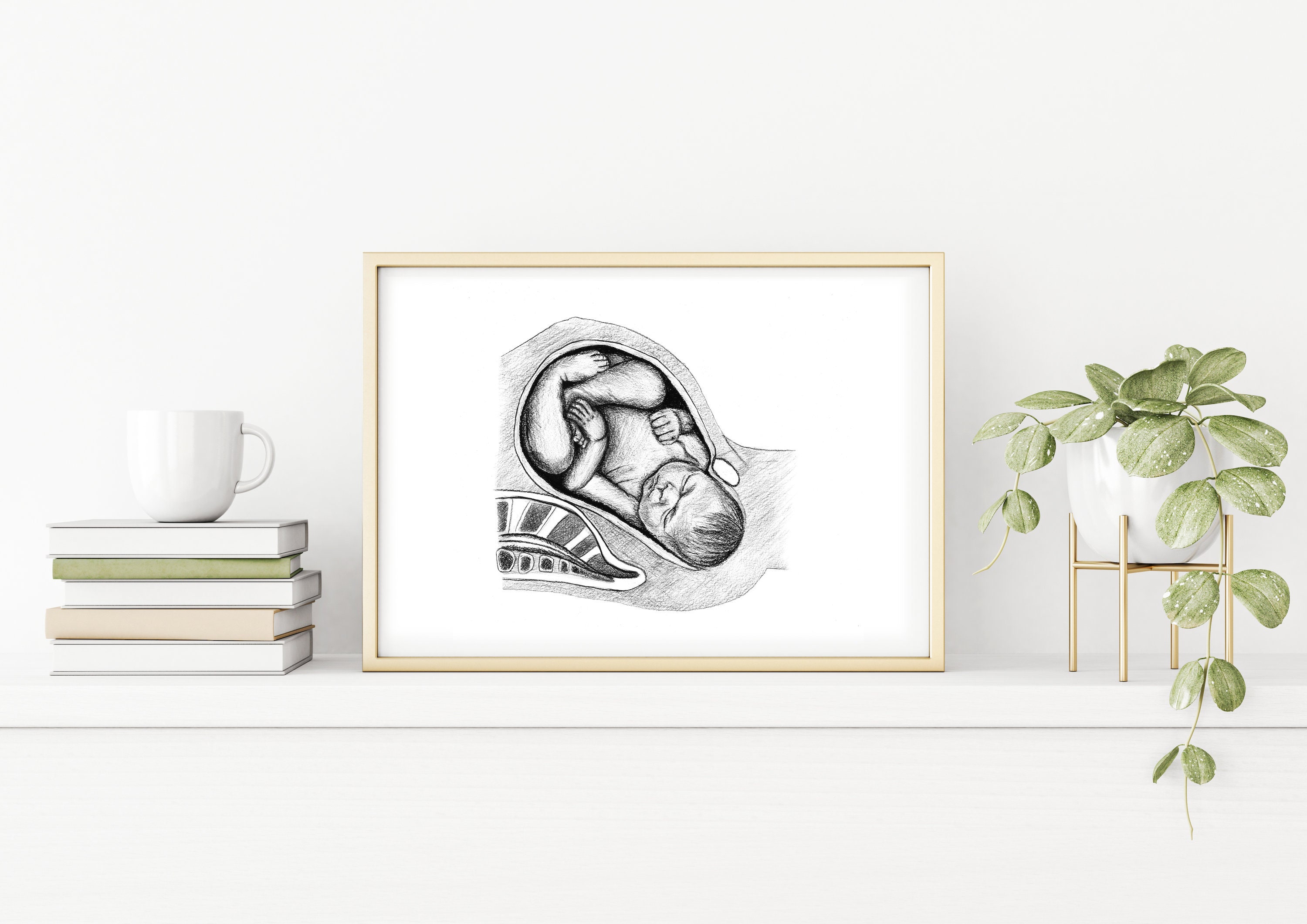 Shoulder Dystocia: Birth/doula Art Printable - Etsy