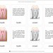 Parts of a Human Tooth Puzzle With Nomenclature Cards (6-9 ...