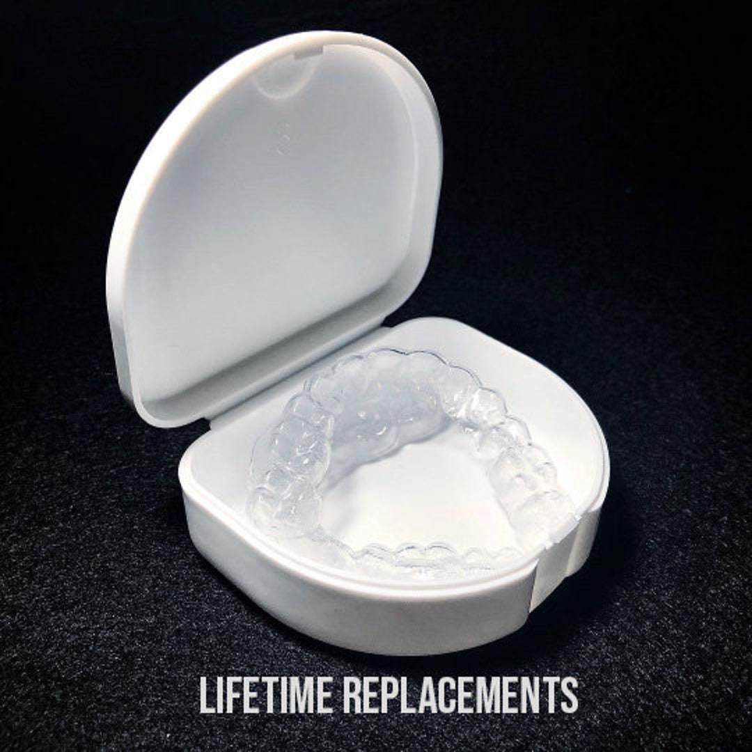 Custom Dental Retainers - Upper and Lower - Etsy