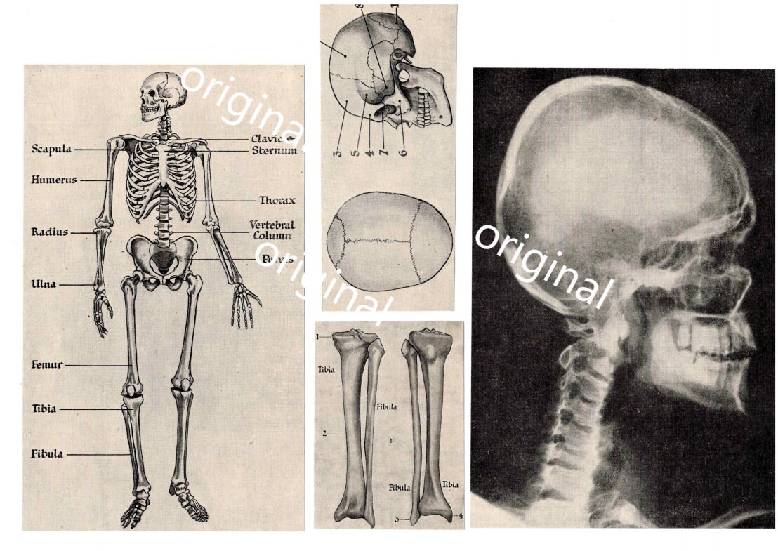 1930s Vintage Halloween Anatomy Digital Download: PDF Bone Muscle Nerve ...