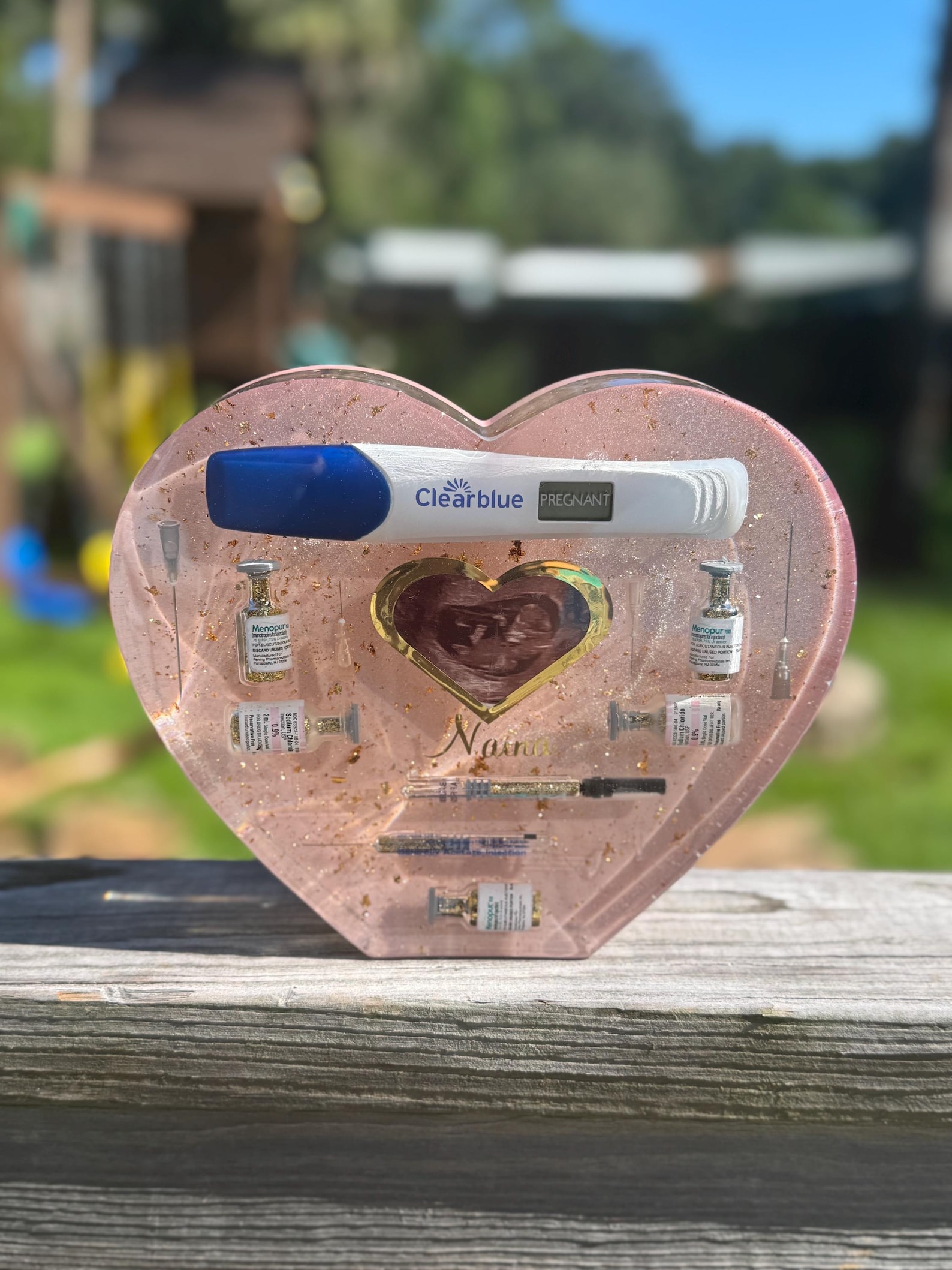 IVF Art, Fertility Heart, in Vitro, Sonogram Picture, Newborn Gift ...