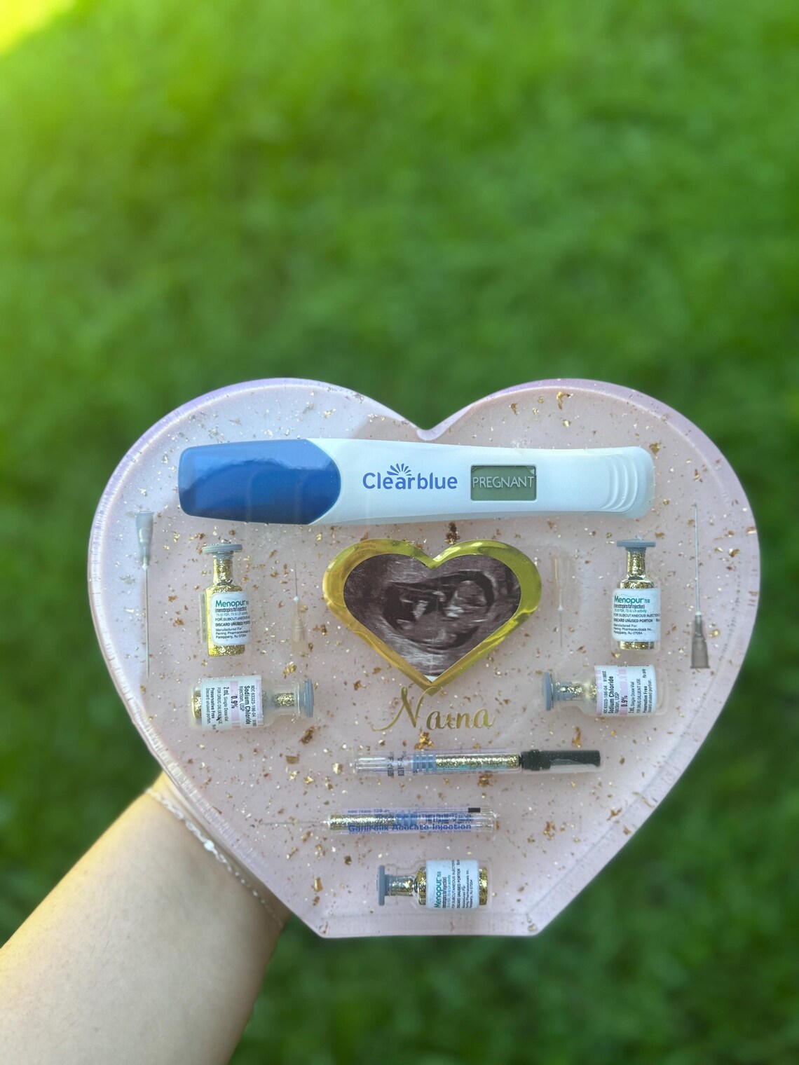 IVF Art, Fertility Heart, in Vitro, Sonogram Picture, Newborn Gift ...
