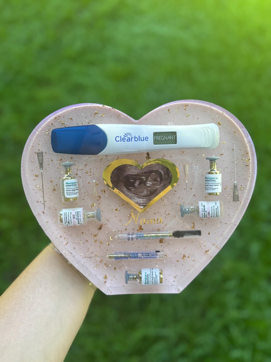 IVF Art, Fertility Heart, in Vitro, Sonogram Picture, Newborn Gift ...