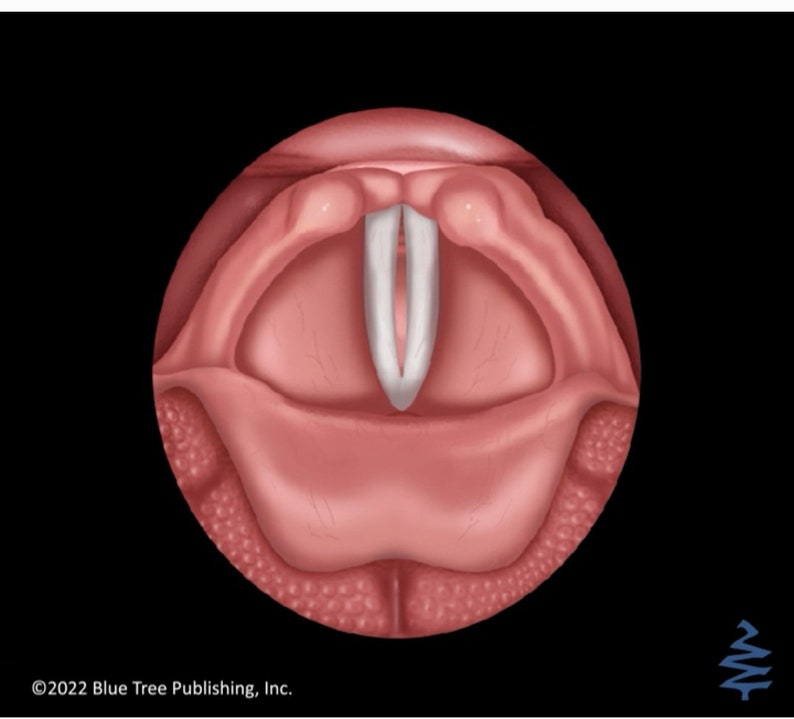 Speech Articulation Large Poster With QR Codes - Etsy