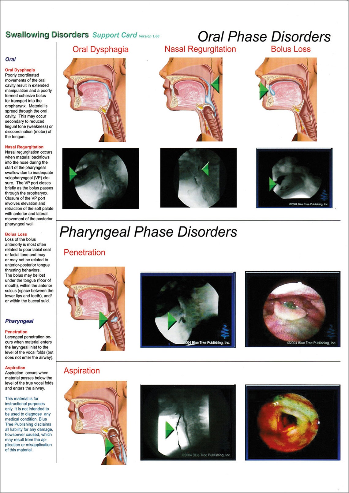 Swallowing Disorders Anatomical Chart - Etsy