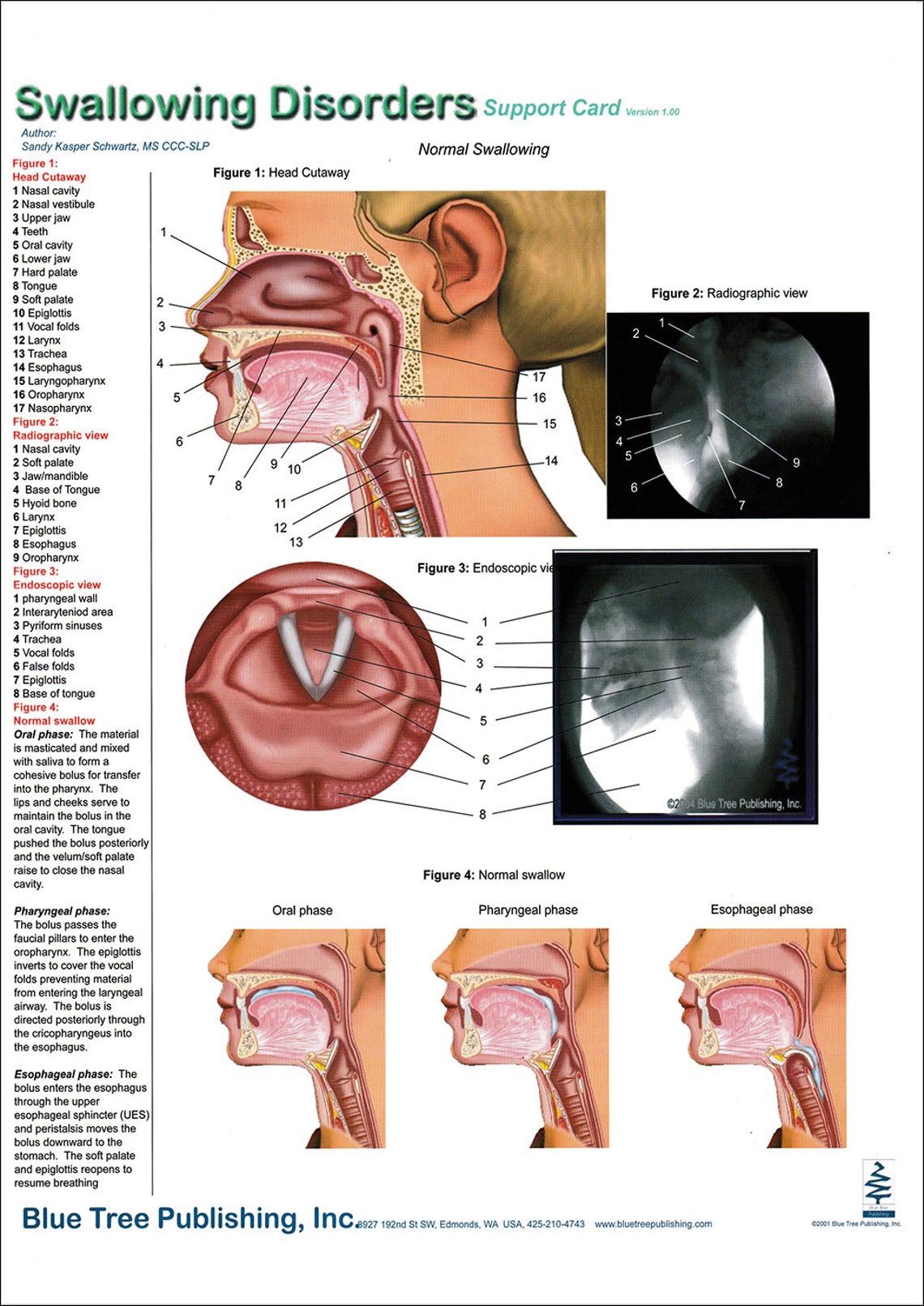 Swallowing Disorders Anatomical Chart - Etsy