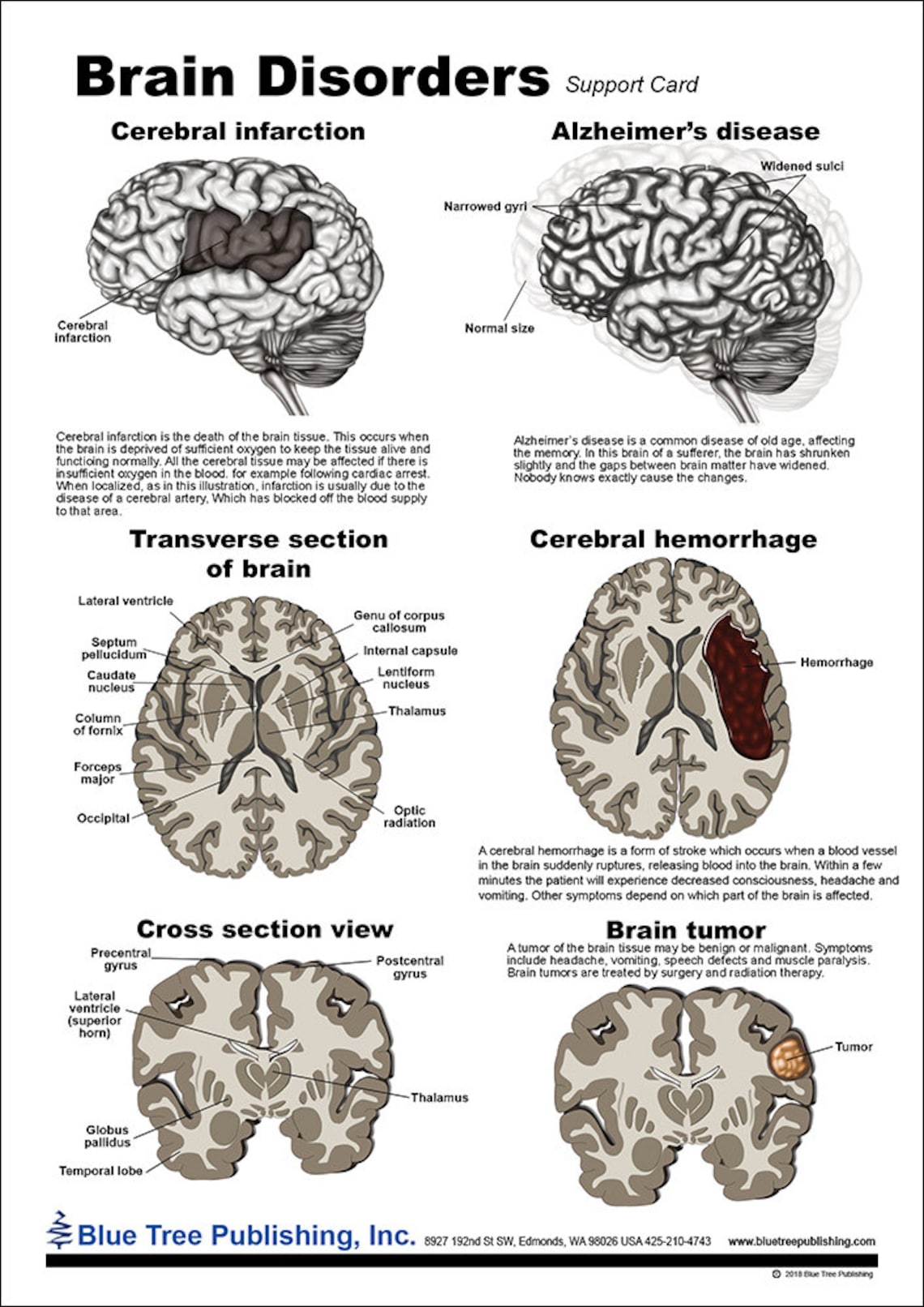 Brain Disorders Anatomical Chart - Etsy
