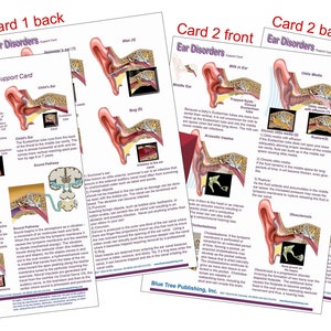 Ear Disorders Anatomical Charts - Etsy
