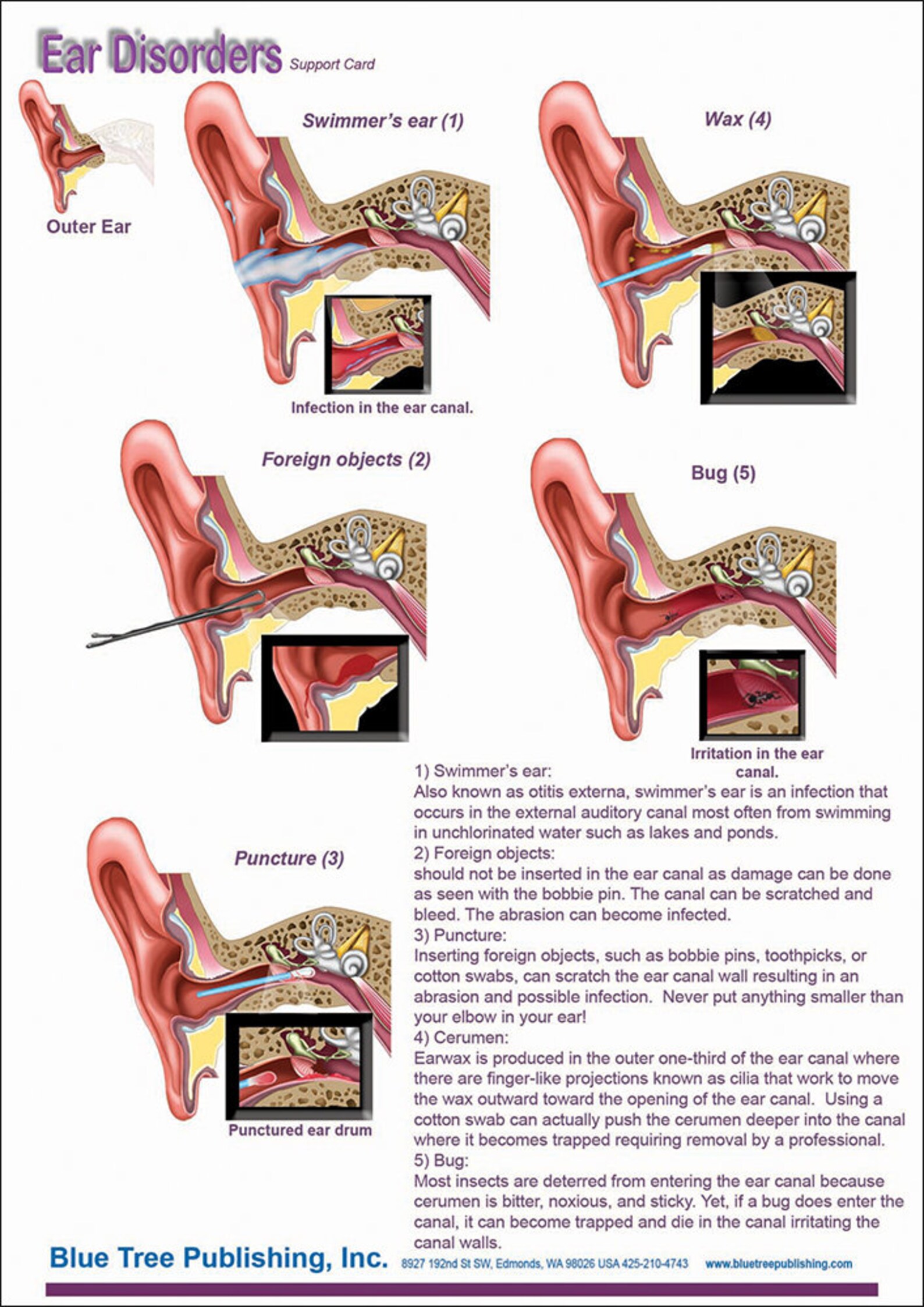 Ear Disorders Anatomical Charts - Etsy