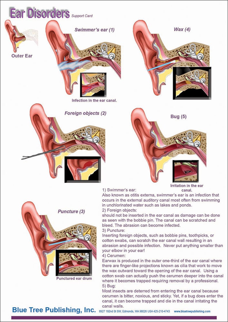 Ear Disorders Anatomical Charts - Etsy