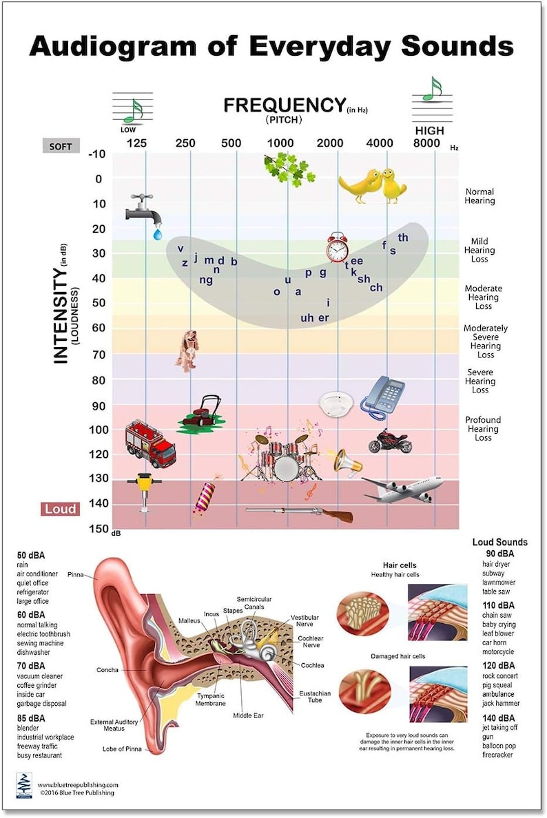 Ear Education for Audiologist Poster Charts and Model - Etsy