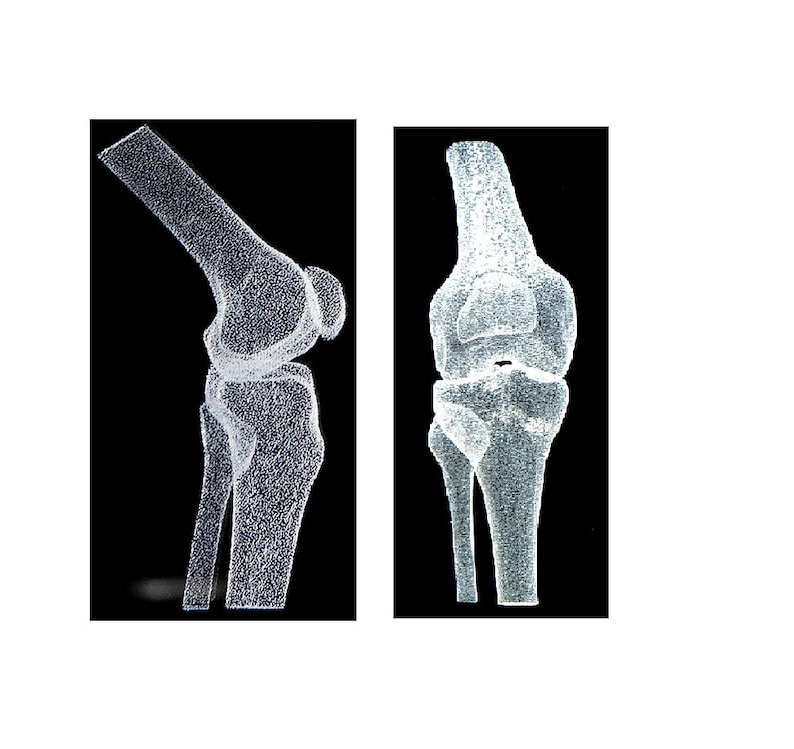Knee Joint 3d Laser Key Chain Crystal, Anatomy, Bone, Physical Therapy ...