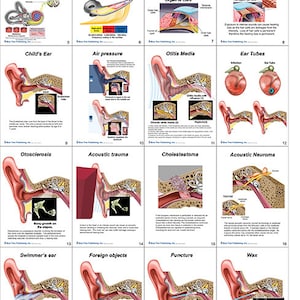 Ear Anatomy Flip Charts for Audiologist and Students of Audiology - Etsy