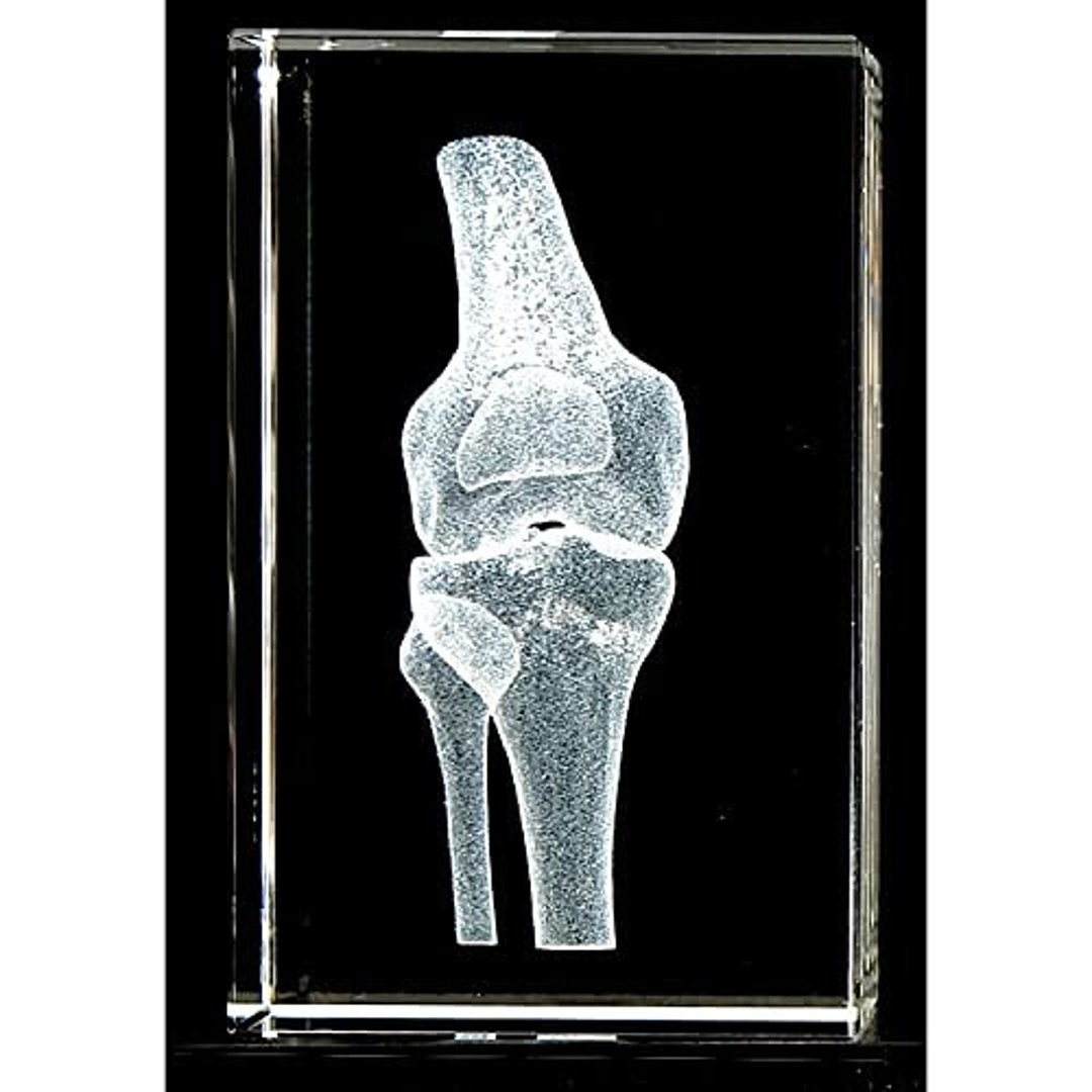 Knee Joint 3d Laser 1lb Crystal, Anatomy, Bone, Physical Therapy Sports ...