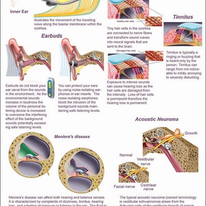 Ear Disorders Anatomical Charts - Etsy