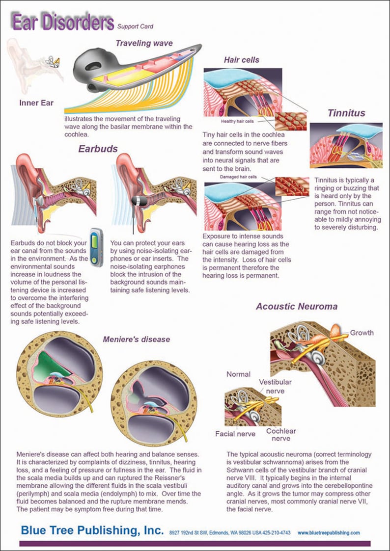 Ear Disorders Anatomical Charts - Etsy