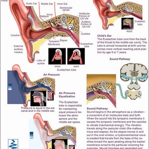 Ear Disorders Anatomical Charts - Etsy