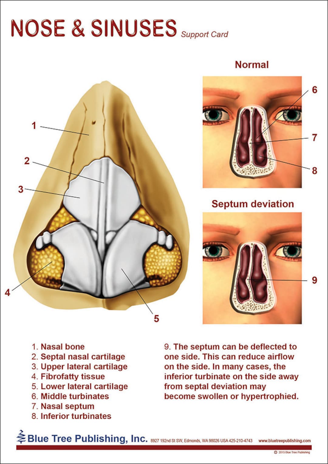 Nasal Septal Deviation | lupon.gov.ph Nasal Septal Deviation | lupon.gov.ph