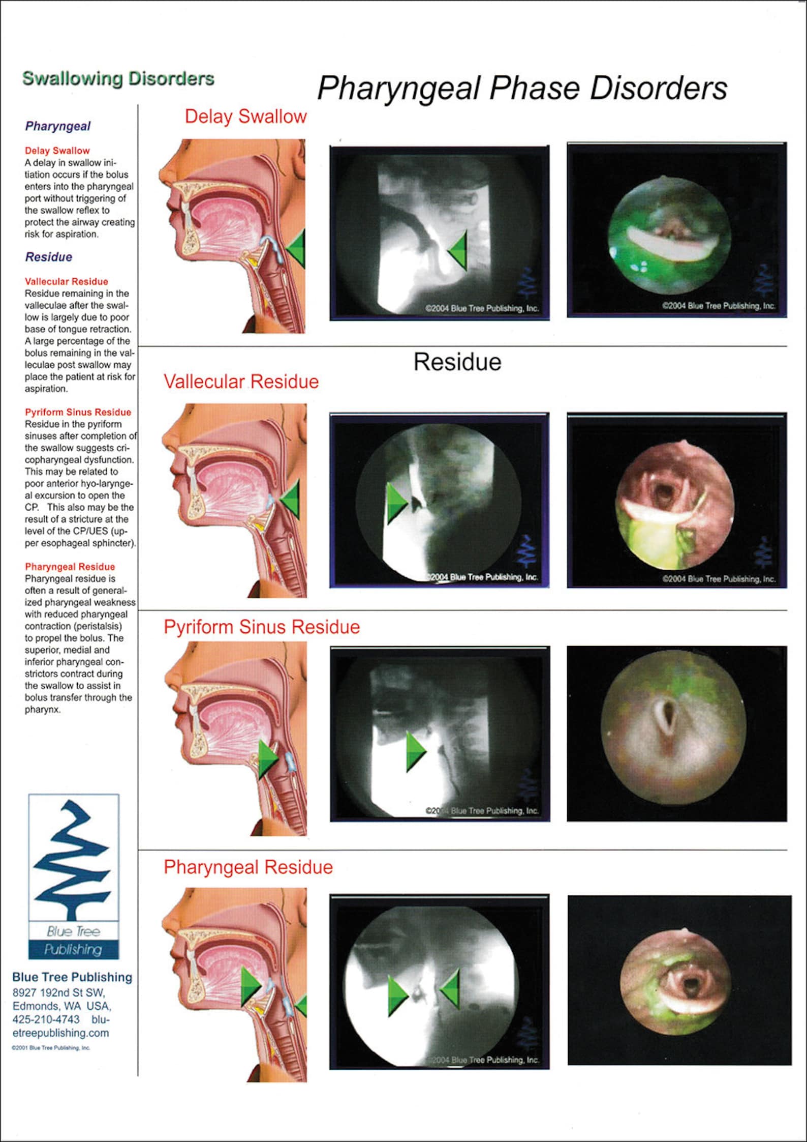 Swallowing Disorders Anatomical Chart - Etsy