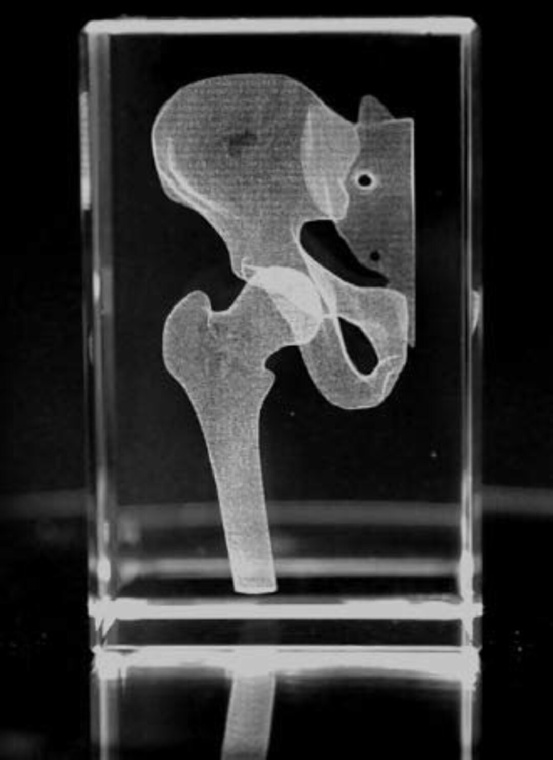 Hip Joint 3D Laser 1lb Crystal With Skeleton Sticky Note, Anatomy, Bone ...
