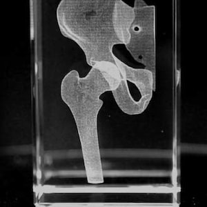 Hip Joint 3D Laser 1lb Crystal With Skeleton Sticky Note, Anatomy, Bone ...