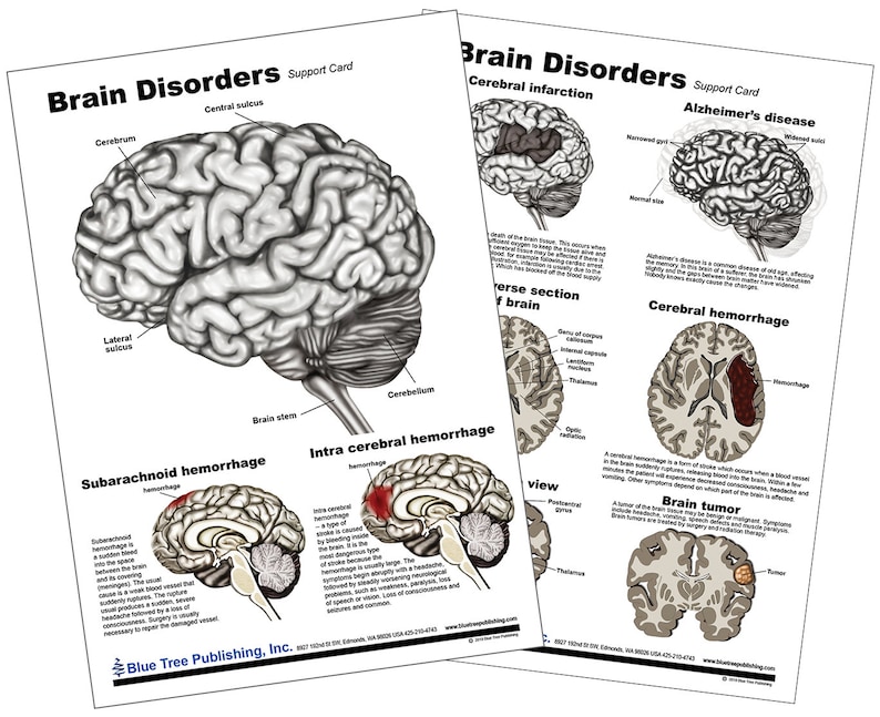 Brain Disorders Anatomical Chart - Etsy