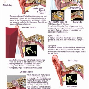 Ear Disorders Anatomical Charts - Etsy