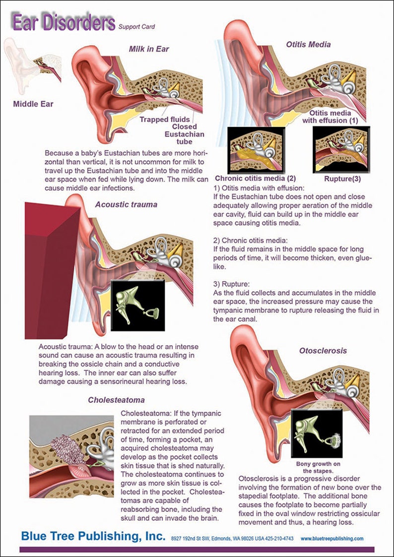 Ear Disorders Anatomical Charts - Etsy