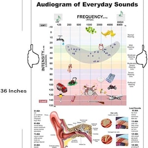 Ear Education for Audiologist, Poster, Charts and Model - Etsy