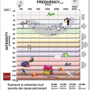Audiogram Daily Noise Anatomical Chart - Etsy