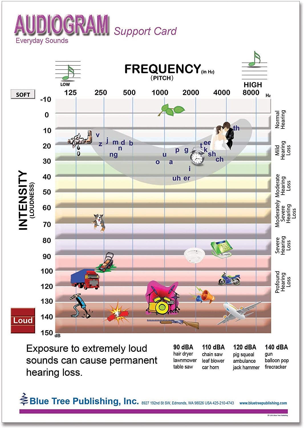 Audiogram Daily Noise Anatomical Chart - Etsy
