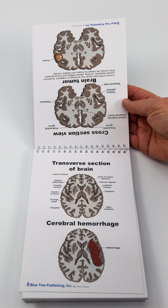 Brain Anatomy Flip Charts for Study of Neurology, Cranial Nerves ...