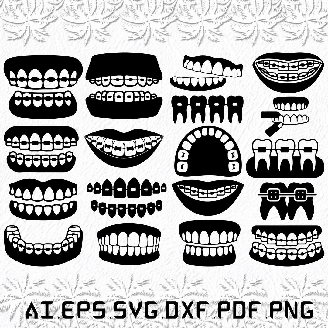 Braces Svg, Braces Svg, Braces Svg, Tooth, Man Braces, SVG, Ai, Pdf ...