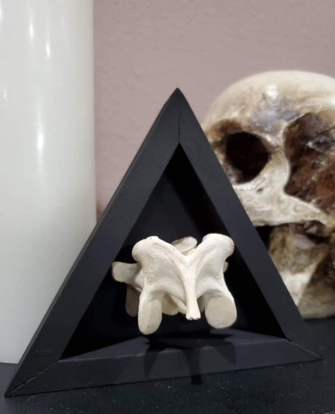 Set of Spine Displays | Bones | Bone Decor - Etsy