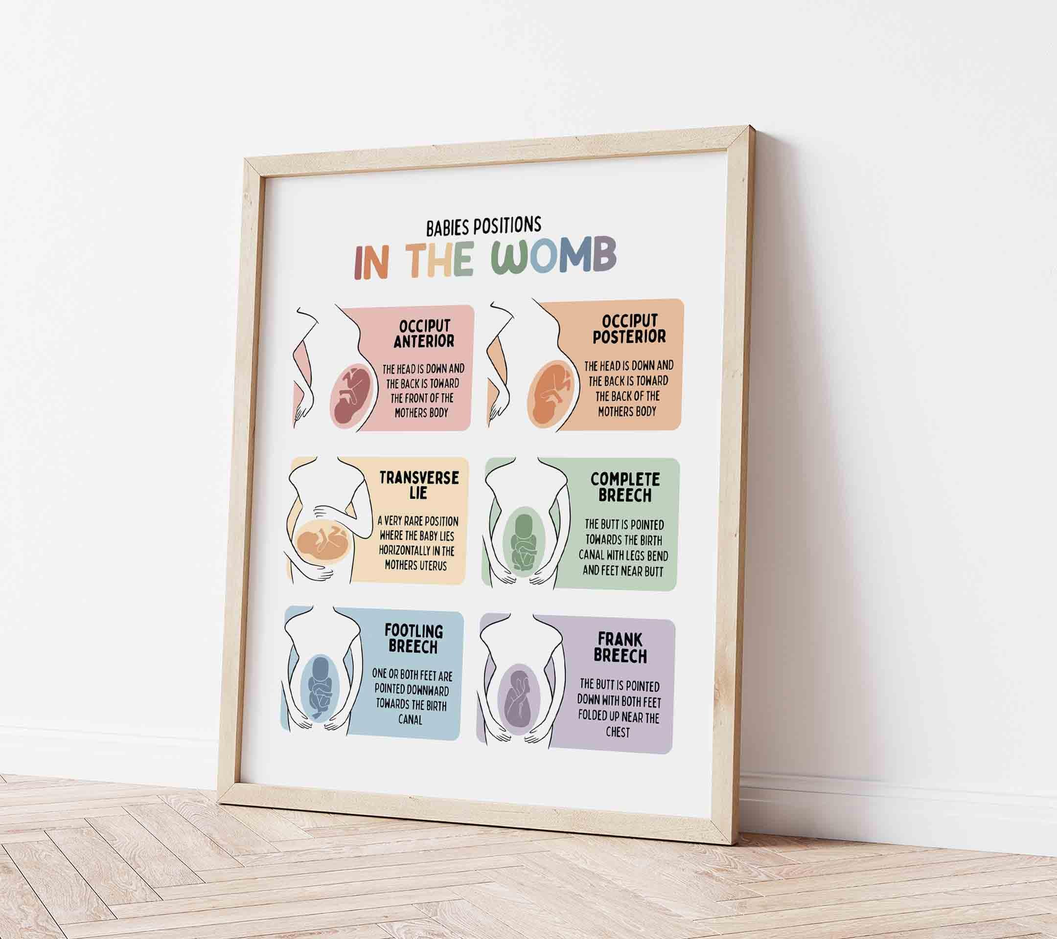 Baby Positions in the Womb Poster (digital Download) Medical Biology ...