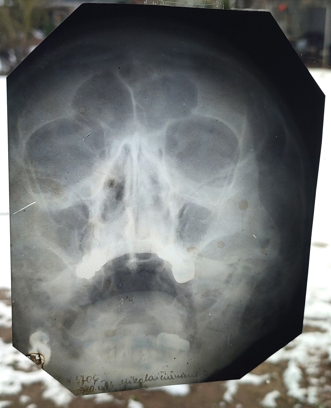 Real Medical X-ray Photo 1980 X-ray of the Woman Face, Nose the Human ...