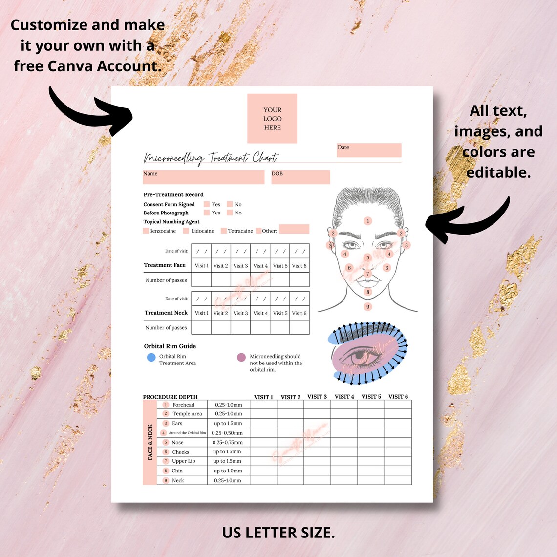 Microneedling Treatment Charts for Face & Body I Informed - Etsy