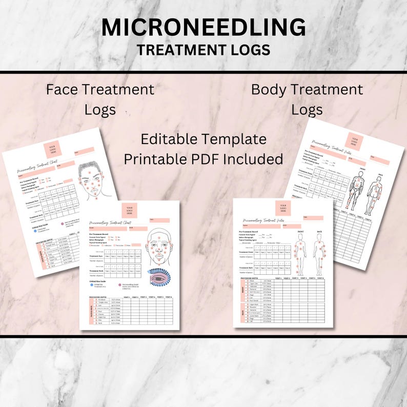 Microneedling Treatment Forms: Face & Body Charts (editable Canva ...