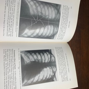 Roentgen Interpretation, 1936 - Etsy