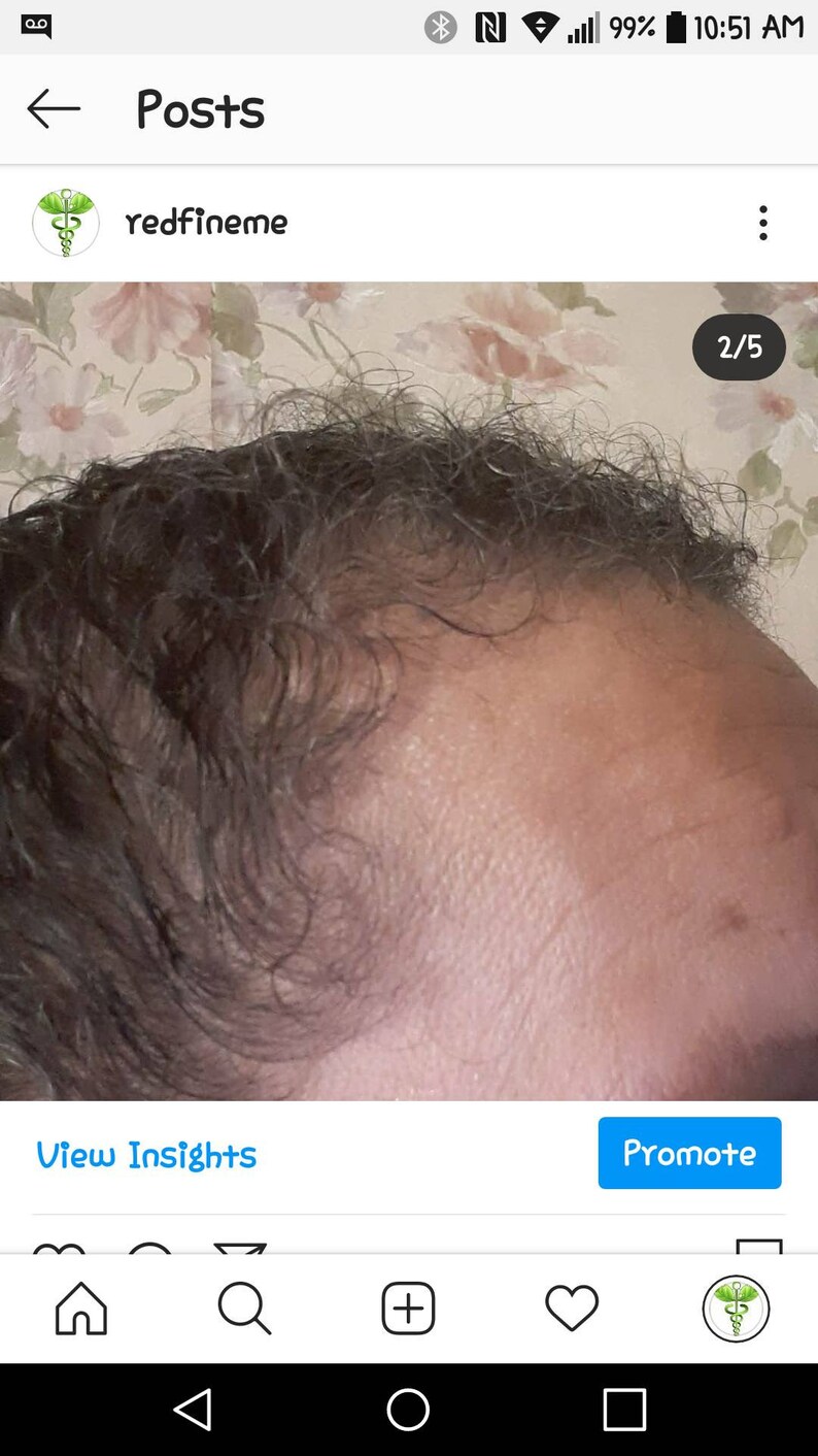 Homade Chebe & Black Rice Hair Butter| Growth, Hair Thickener, Dry ...