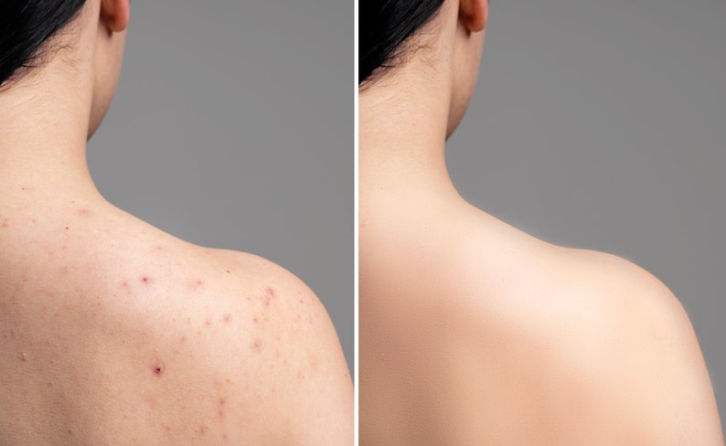 High-end Skin Smoothing Photoshop Action: Photo Retouch (ATN File, PDF ...