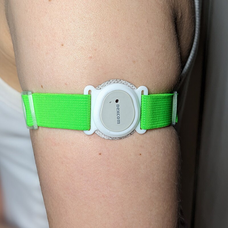 Dexcom G7 Fixation Strap Fixation Holder With Adjustable Wrist - Etsy